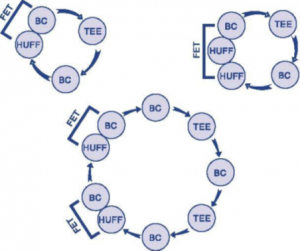 The active cycle of breathing technique - Bronchiectasis