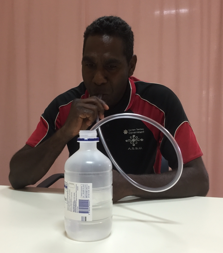 Airway Clearance & Exercise - Bronchiectasis