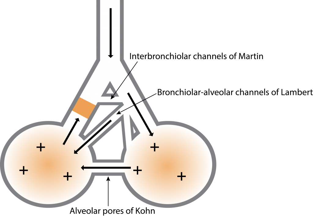 The active cycle of breathing technique - Bronchiectasis