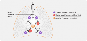 Forced Expiration Technique - Bronchiectasis