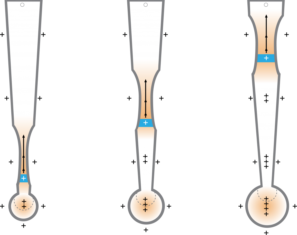 The active cycle of breathing technique - Bronchiectasis