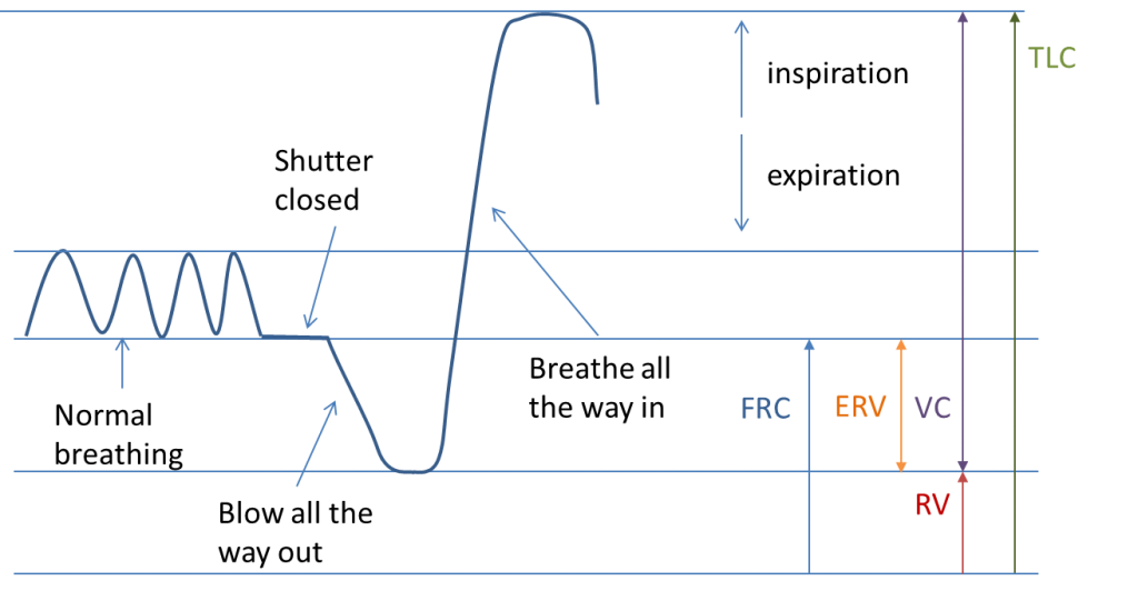 Lung Function - Bronchiectasis