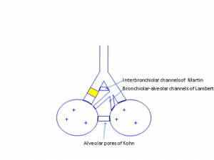 collateral channels - Bronchiectasis