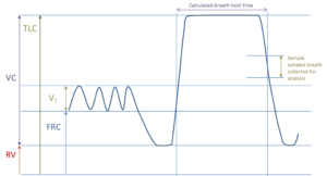 Volume-Time-trace-1024x553 - Bronchiectasis